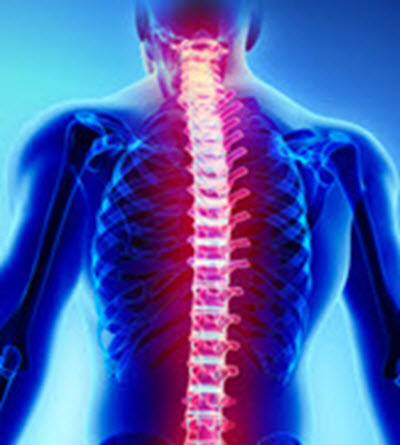 The Long-Term Impact of Spinal Cord Injuries